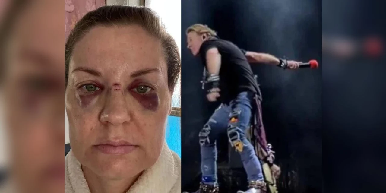 Fã precisa ser socorrida após vocalista do Guns N' Roses arremessar ...